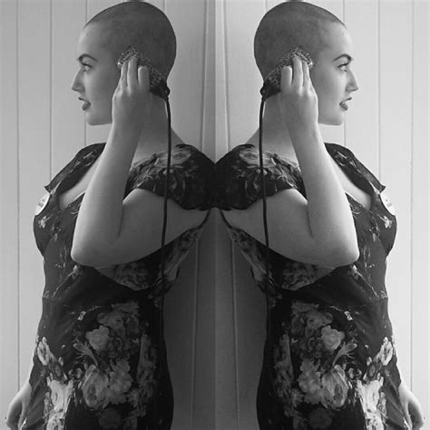 Meet The Woman Redefining Baldness And Beauty Metro News
