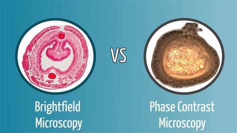 Brightfield Vs Phase Contrast Microscopy The Differences Explained
