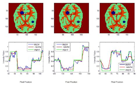 tomography free full text a novel iterative mlem image reconstruction algorithm based on