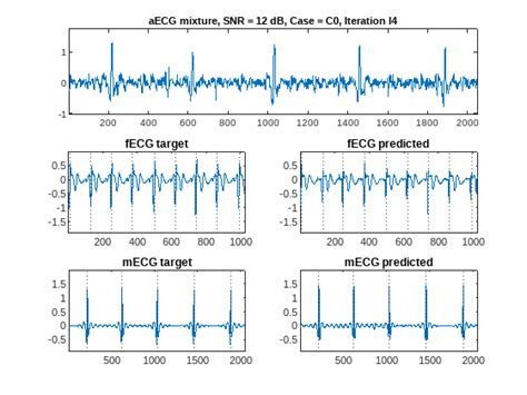signal source separation using w net architecture matlab and simulink