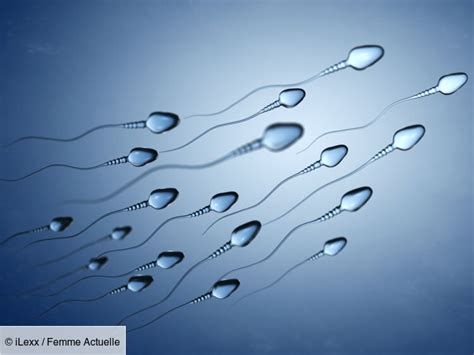 Spermocytogramme Utilité Déroulement Et Lecture Des Résultats Femme Actuelle Le Mag