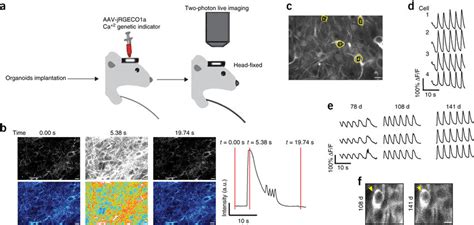 two photon imaging reveals neuronal activity in the graft a download scientific diagram