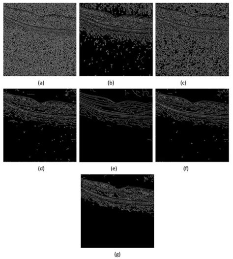 micromachines free full text non local mean denoising algorithm based on fractional compact