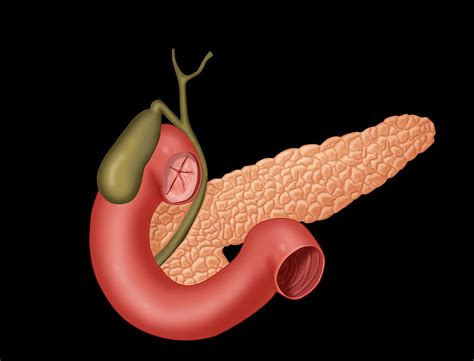 Anatomy Of Biliary System Illustration Bild Kaufen 12040474 Science