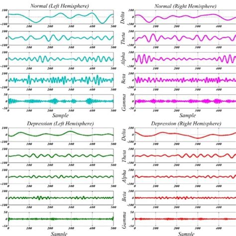 five rhythms of normal and depression eeg signals for both hemispheres download scientific diagram