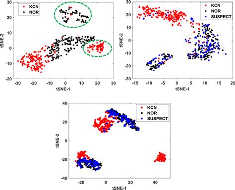 visualization of 7000 deep features extracted by the efficientnet b0 dl download scientific