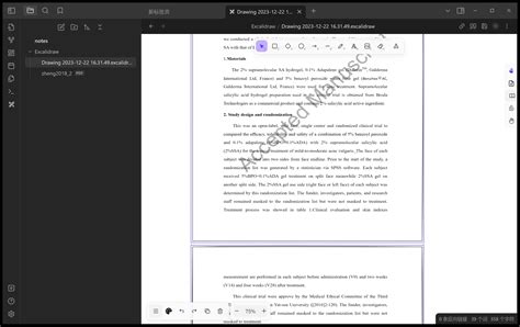 找不到excalidraw里的pdf荧光标注栏 疑问解答 Obsidian 中文论坛