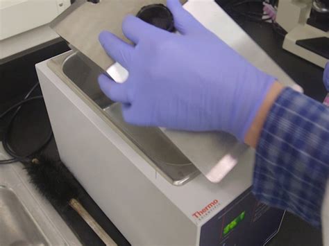 Application Of High Speed Super Resolution SPEED Microscopy In Live