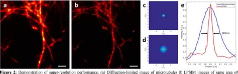 Figure 2 From High Speed Super Resolution Microscopy For Biological