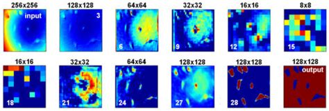 u net convolutional neural network model the u net model contains two hot sex picture