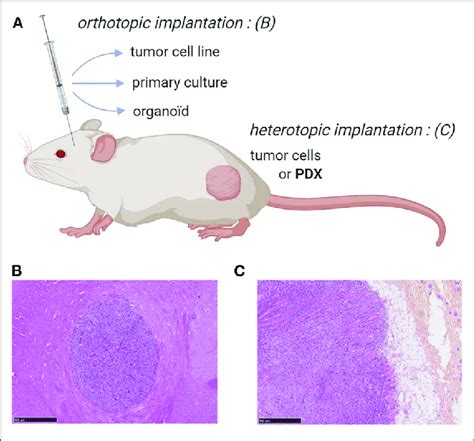 mouse models for ortho or heterotopic administrations of human tumor download scientific