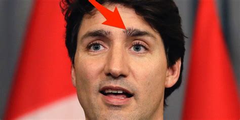 Justin Trudeaus Eyebrows Looked Fake But Theyre Just Uneven Business Insider
