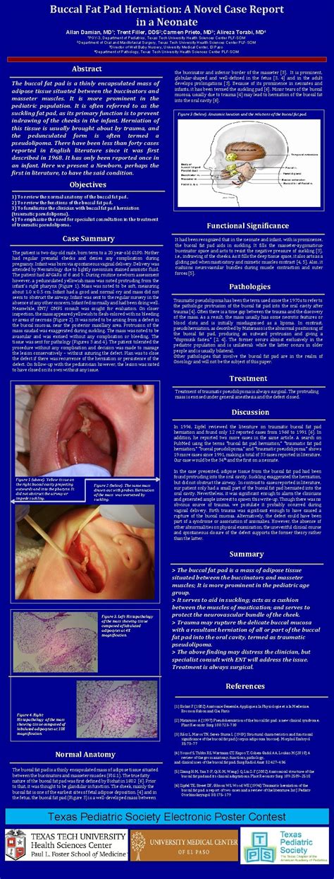 Buccal Fat Pad Herniation A Novel Case Report