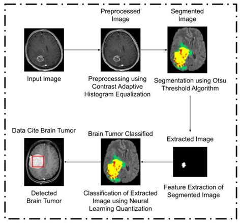 healthcare free full text earlier detection of brain tumor by pre processing based on