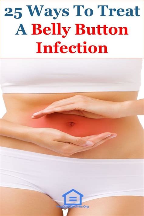 How To Treat A Belly Button Infection 25 Natural Remedies This Article Discusses Ideas On The