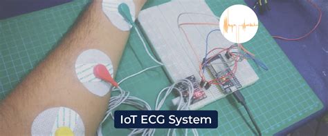 Ad8232 Ecg Module Pinout Interfacing With Arduino 60 Off
