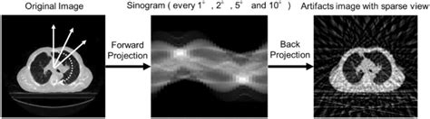 reducing image artifacts in sparse projection ct using conditional generative adversarial