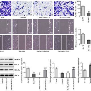 AIM2 Overexpression Inhibits The Invasion Migration And EMT Of