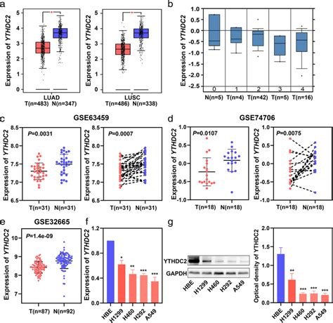 YTHDC2 Is Downregulated In NSCLC Tissues And Cell Lines A YTHDC2