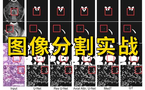 研究生必看！图像分割经典项目实战之u net医学细胞分割实战 学不会up主下跪！ 人工智能 深度学习 图像分割 图像处理