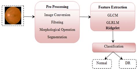 diabetic retinopathy automated detection