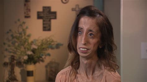 Lizzie Velasquez Pics Telegraph
