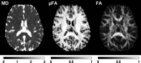 constrained optimization of gradient waveforms for generalized diffusion encoding abstract