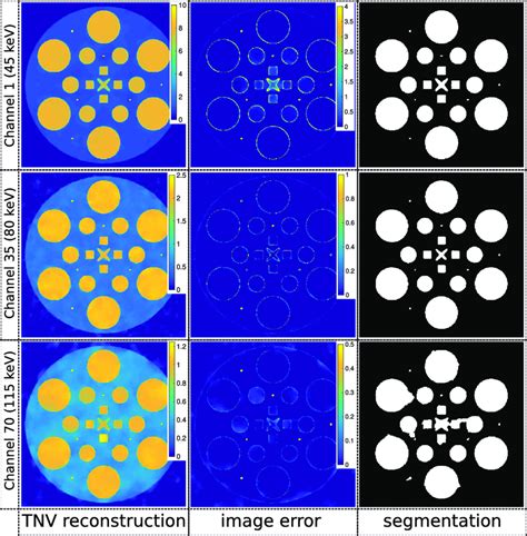 reconstruction image error and segmentation for tnv method with β opt download scientific