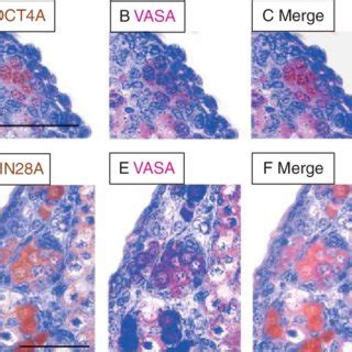 Co Localization Of Pluripotency Markers With The General Germ Cell