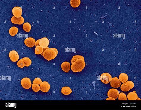 Color Ehanced Scanning Electron Micrograph SEM Of Staphylococcus